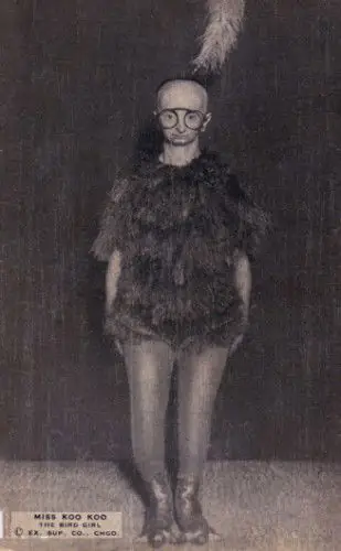 10 Unbelievable Vintage Circus Freaks