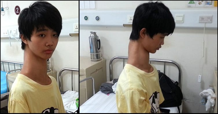 Chinese Kid With An Unusually Long Neck