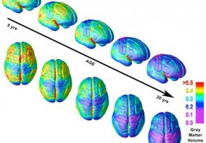 10 Astounding Facts About Human Brain