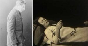Encephalitis lethargica: The Mysterious "Sleepy Sickness" from 1916