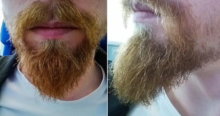 10 Crazy Fads that Were Gloriously Burned to the Ground!
