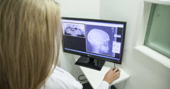 This Gene Mutation Causes Abnormally Dense Bones that Never Fracture