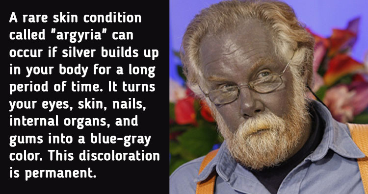 10 of the Rarest Diseases With Unusual Symptoms