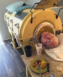 Paul Alexander: The Man Living Inside an Iron Lung for 70 Years
