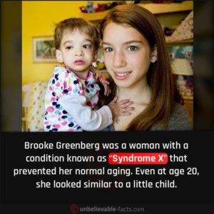 100 Weird Facts That Sound Too Bizarre to be True