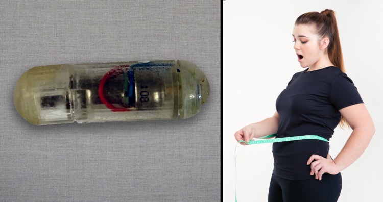 MIT’s Vibrating Pill Could Be a Promising Cure for Obesity