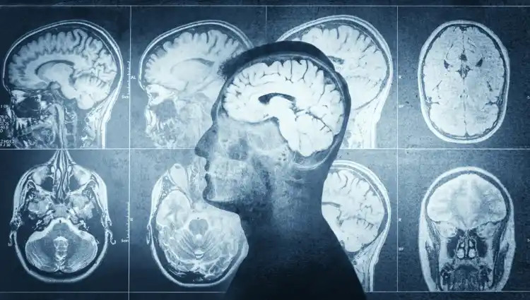 Chris Sands' hiccups revealed a tumor; removal saved his life