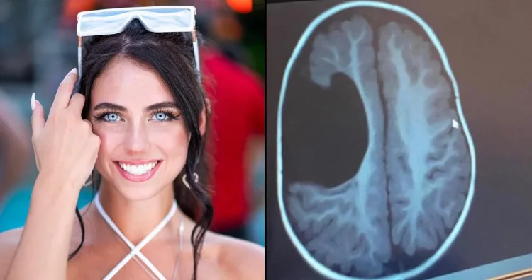 10 Unusual Features of the Human Body