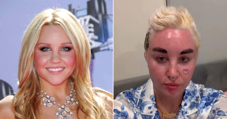 10 Dramatic Celebrity Transformations Over the Years